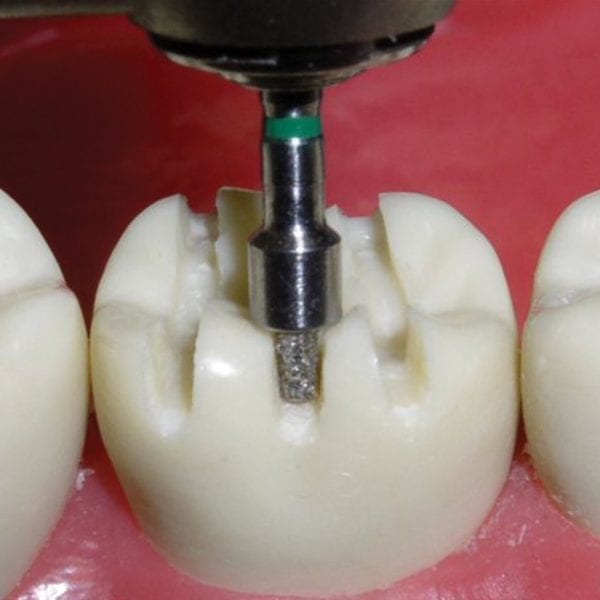 Dental Diamond Burs | Diamond Cutting Disc