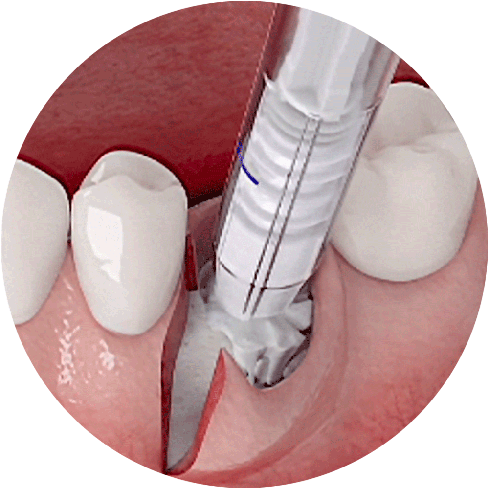 Augma Videos - Strauss Diamond