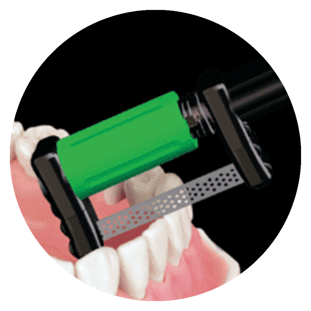 The IPR Solution - Strauss Diamond