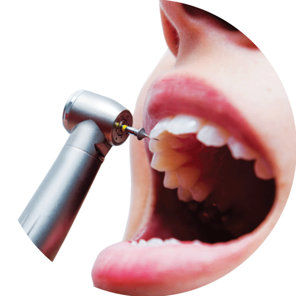 The IPR Solution - Strauss Diamond