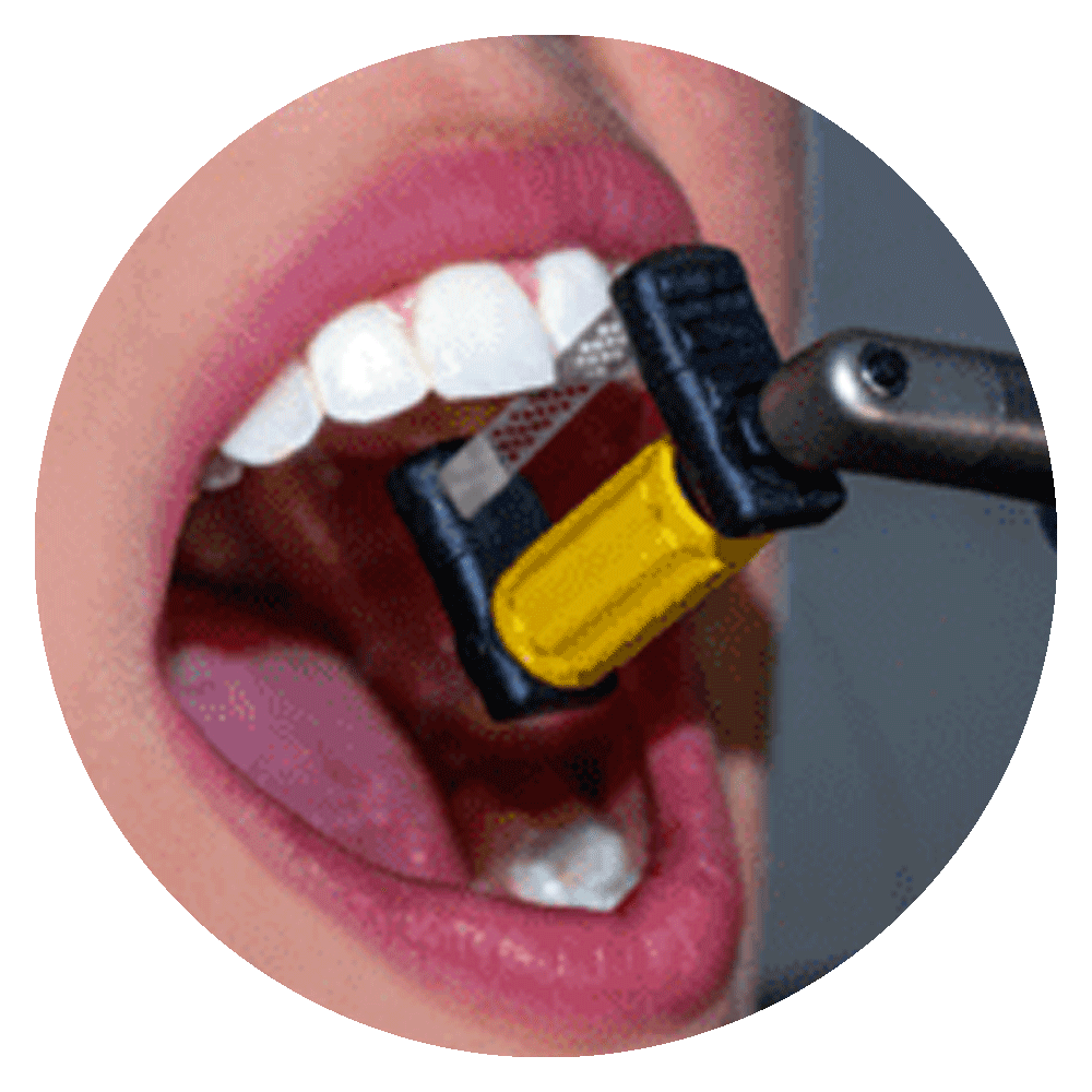 The IPR Solution - Strauss Diamond